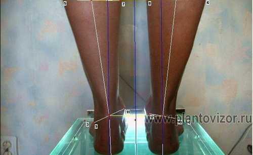 Плантовизор Кузнецова
