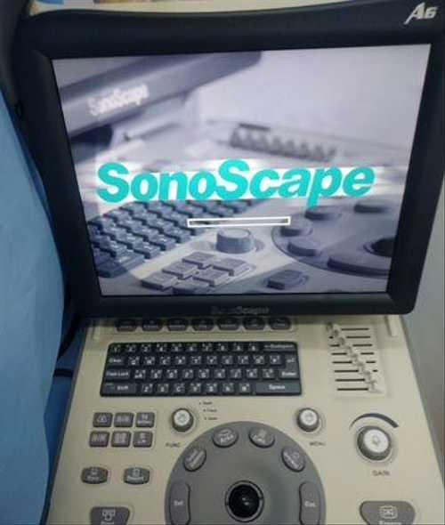 Узи аппарат SonoScape A6 + принтер Sony