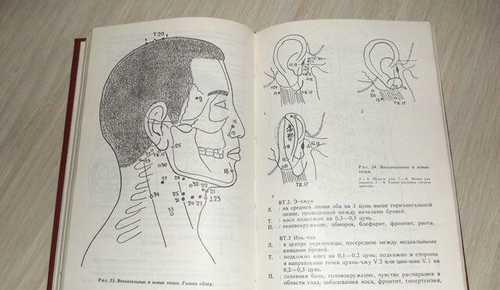 Чжень-цзю терапия важная книга массажистам врачам