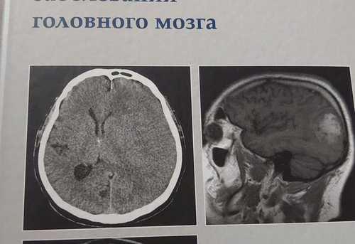Китаев Лучевая диагностика