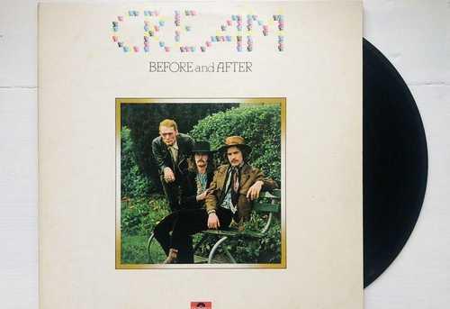 0865 Cream – Before And After