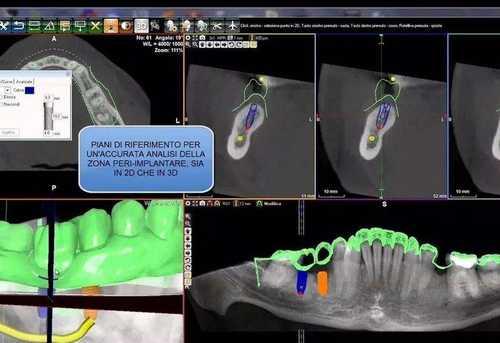 3Diagnosys + plastycad установка