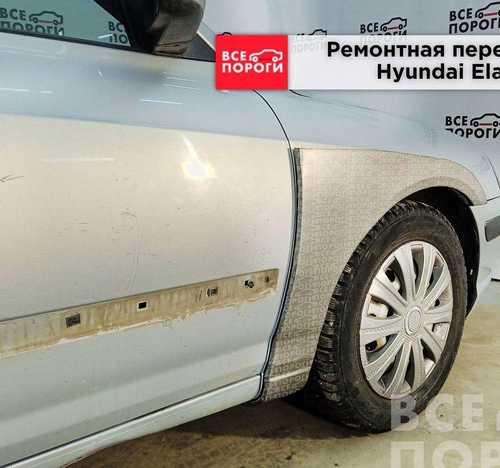 Рем арки для Hyundai Elantra III (XD2)