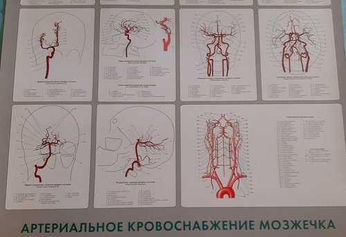 Сосуды для лучевой диагностики. Плакаты 6шт. Дж.Эл