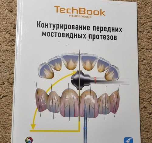 Контурирование передних мостовидных протезов