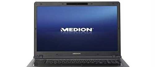 Medion Akoya P8610 - ноутбук с диагональю 18,4"