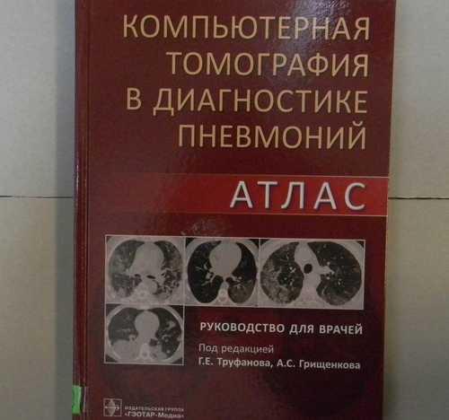 Компьютерная томография в диагностике пневмоний