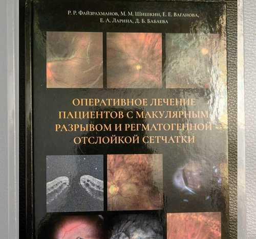 Оперативное лечение пациентов с макулярным разрыво