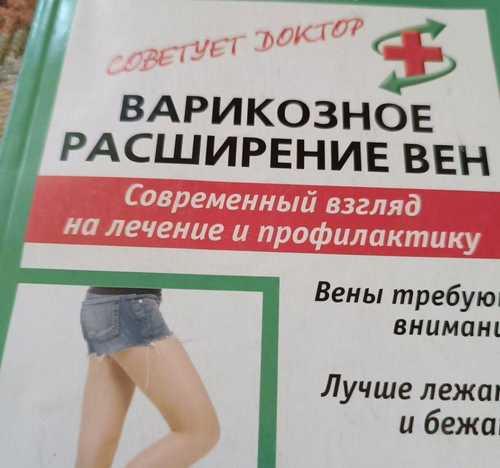 Варикозное расширение вен