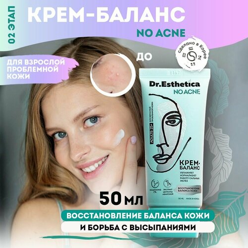 Крем для лица от прыщей, уход за проблемной кожей, DR. ESTHETICA, 50 мл.