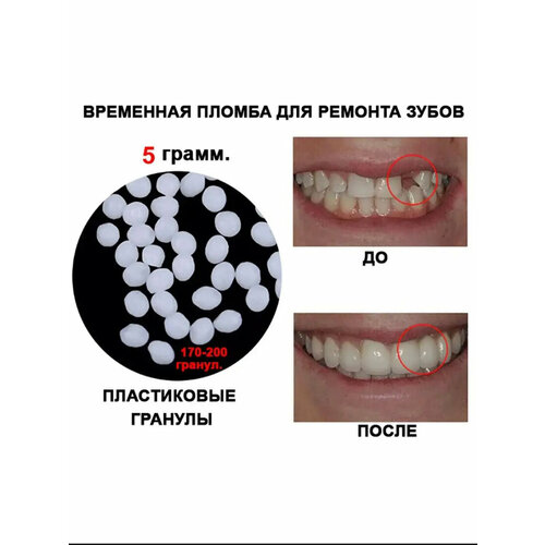 Временная пломба