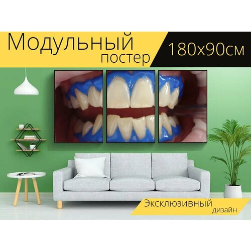Модульный постер "Лазерное отбеливание зубов, стоматологический, отбеливание" 180 x 90 см. для интерьера