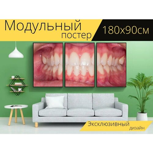 Модульный постер "Зубы, улыбка, дантист" 180 x 90 см. для интерьера