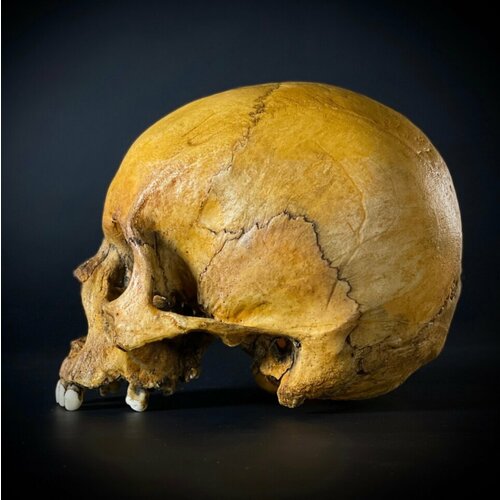 Анатомическая модель черепа без челюсти