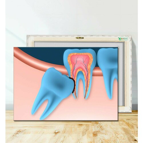 Картина на холсте для интерьера Стоматология, зубы 60х80