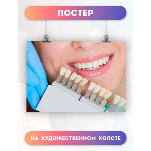 Постер на холсте Стоматология Виниры (11) 60х80 см
