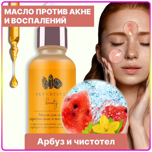 Sky Crystal / Масло средство от акне прыщей и черных точек на лице тоник масло сыворотка для проблемной кожи лица от постакне