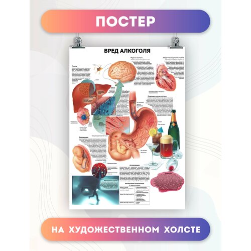 Постер на холсте вред алкоголя болезни медицина (9) 60х80 см