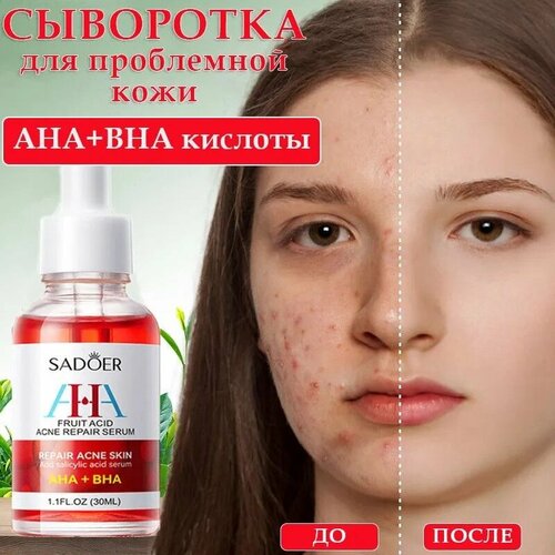 SADOER Сыворотка для лица AHA+BHA, восстанавливающая от прыщей, 30мл