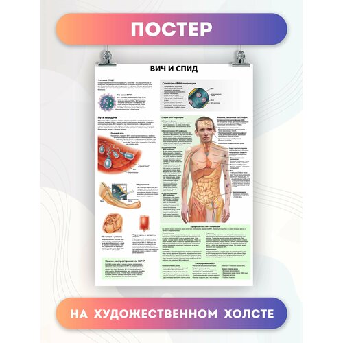 Постер на холсте ВИЧ и Спид болезни медицина (6) 30х40 см