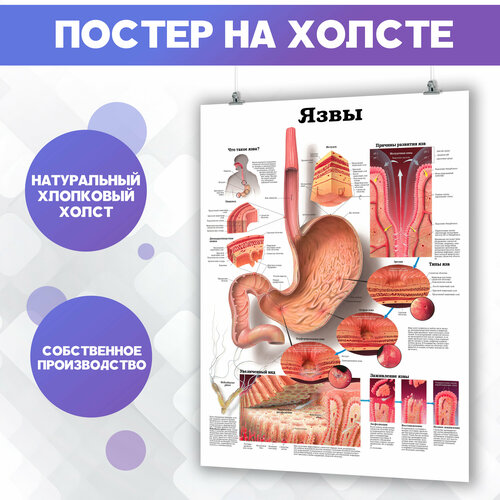 Постер в больницу гастроэнтеролог, анатомия (2) 30х40 см