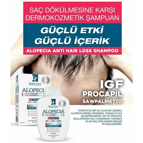 Шампунь Alopecia Anti Hair Loss Herbal против выпадения волос с добавлением IGF, EGF, VEGF, Procapil, Saw Palmetto против выпадения волос 300 мл